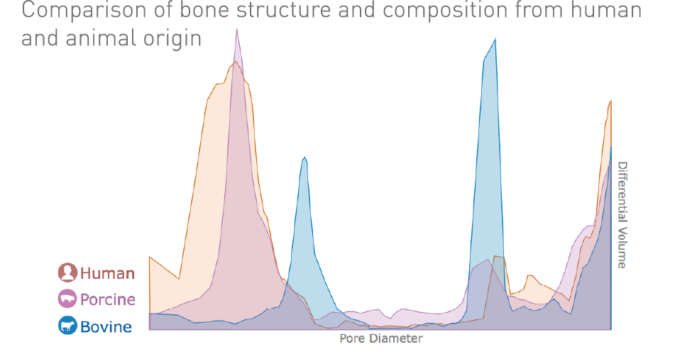 Bone Healing with THE Graft™: Natural Porcine Matrix